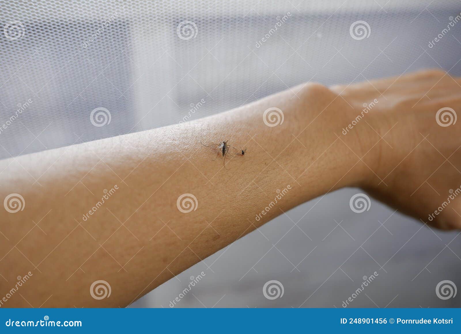 Aedes Mosquito Bites on the Arm Stock Photo - Image of malaria, human ...