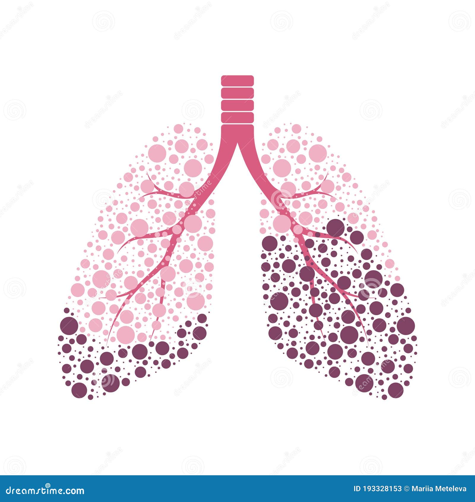 Affected Human Lungs. Sick Lungs Vector Illustration Stock Vector ...