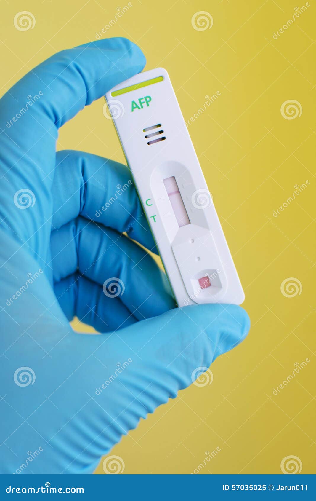 AFP negative stock image. Image of laboratory, tumor - 57035025