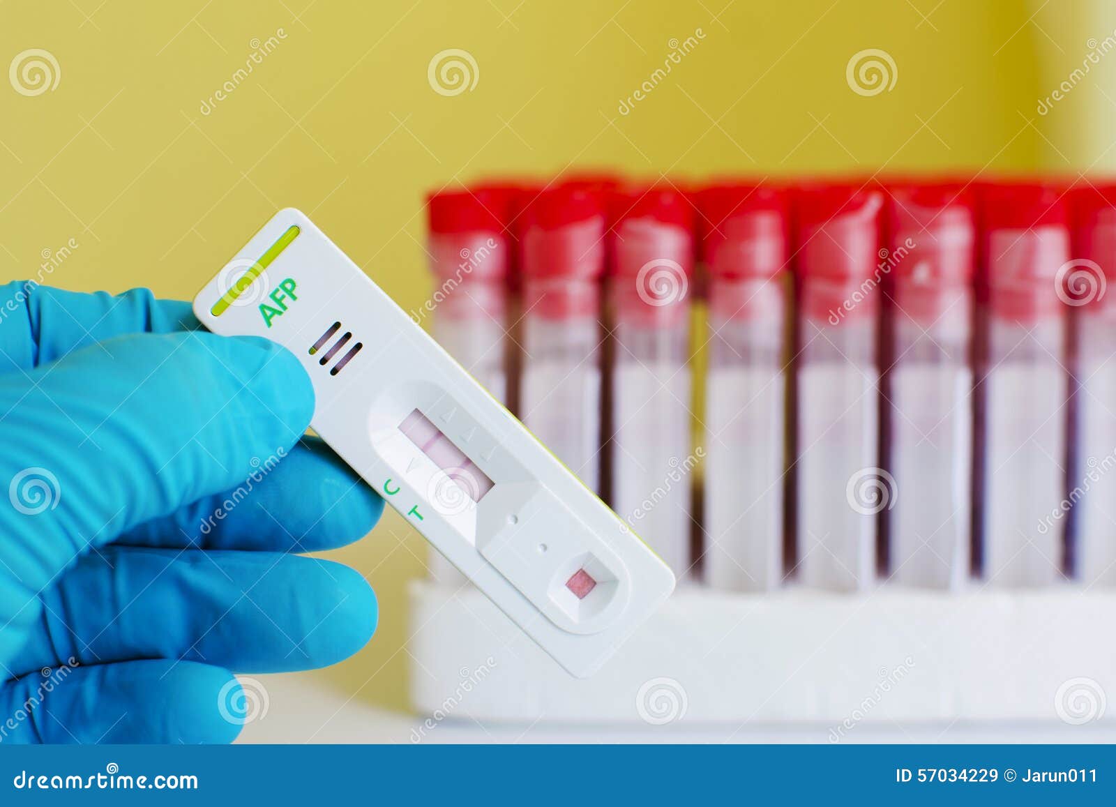 AFP positive stock image. Image of medical, care, analyzing - 57034229