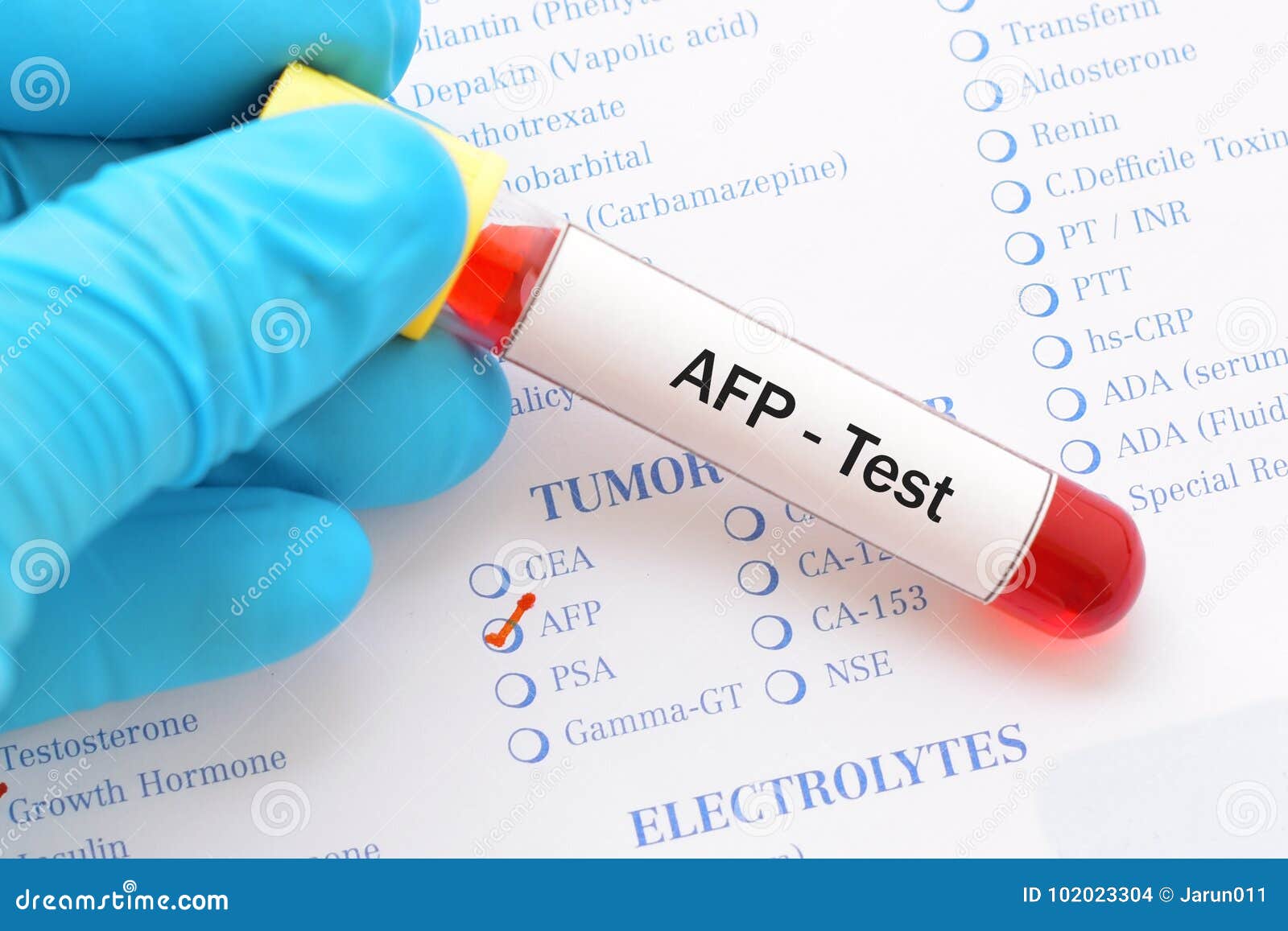 AFP-test stock foto. Image of buis, laboratorium, experiment - 102023304