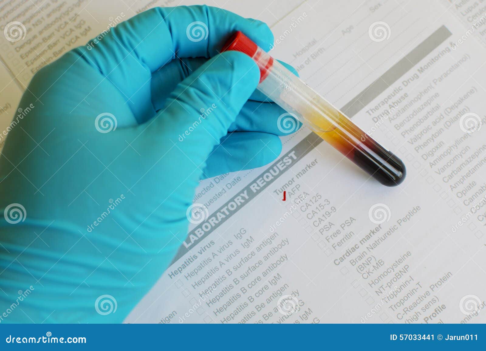 AFP testing stock image. Image of disease, blood, analyzing - 57033441