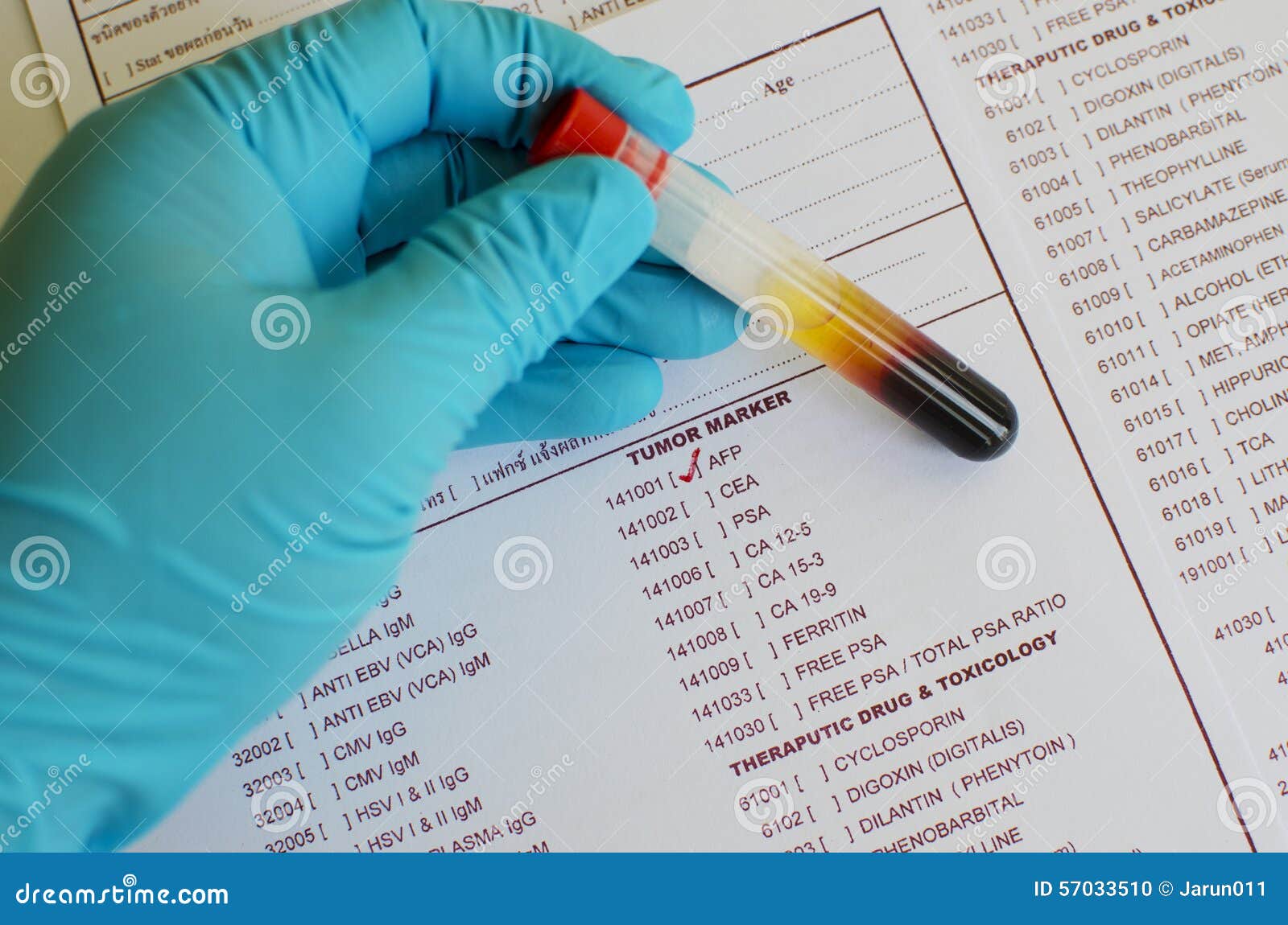 AFP testing stock photo. Image of research, checkup, cancer - 57033510