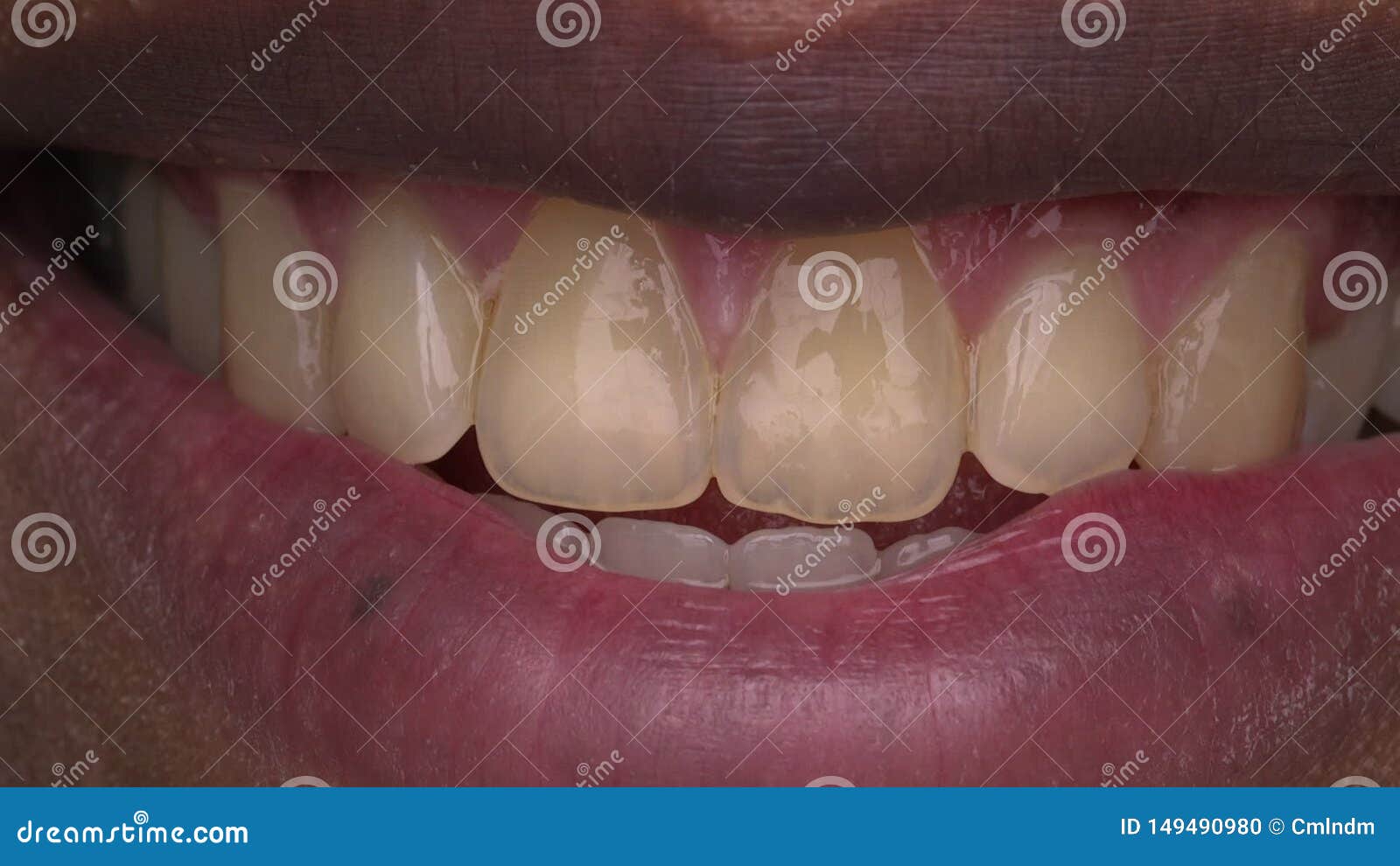 African American Man Shows Yellow Teeth Stock Footage - Video of clean ...