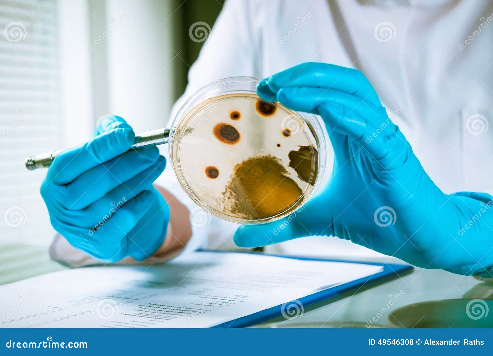 Agar Plate with Growing Germs Stock Photo - Image of agar, dish: 49546308