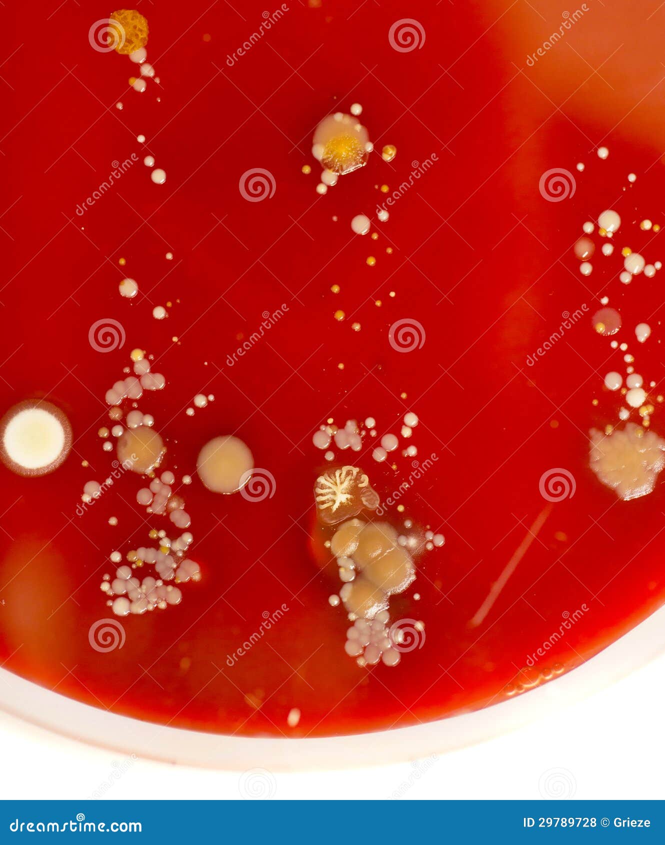 Micro organisms stock photo. Image of health, culture - 29789728