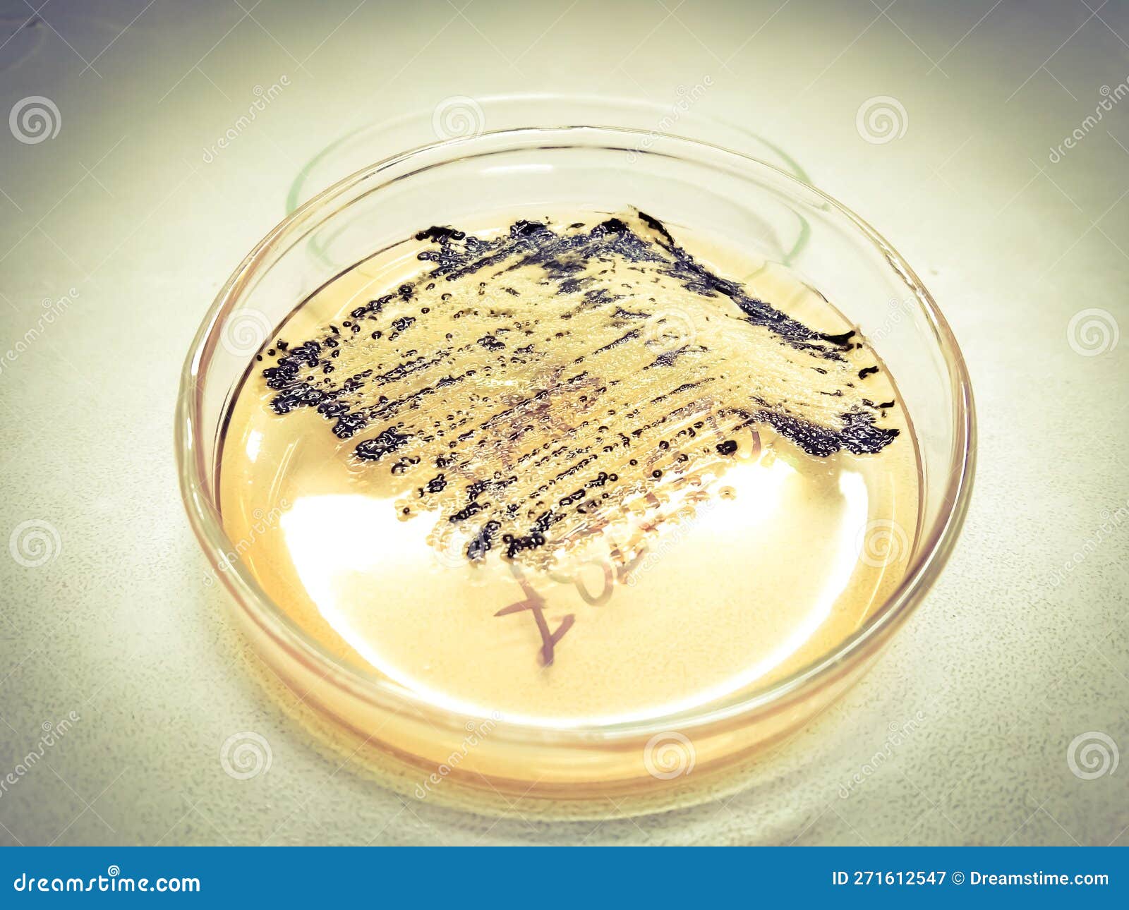 A Agar Plate of Staphylococcus Aureus (foodborne Pathogen) with Black ...