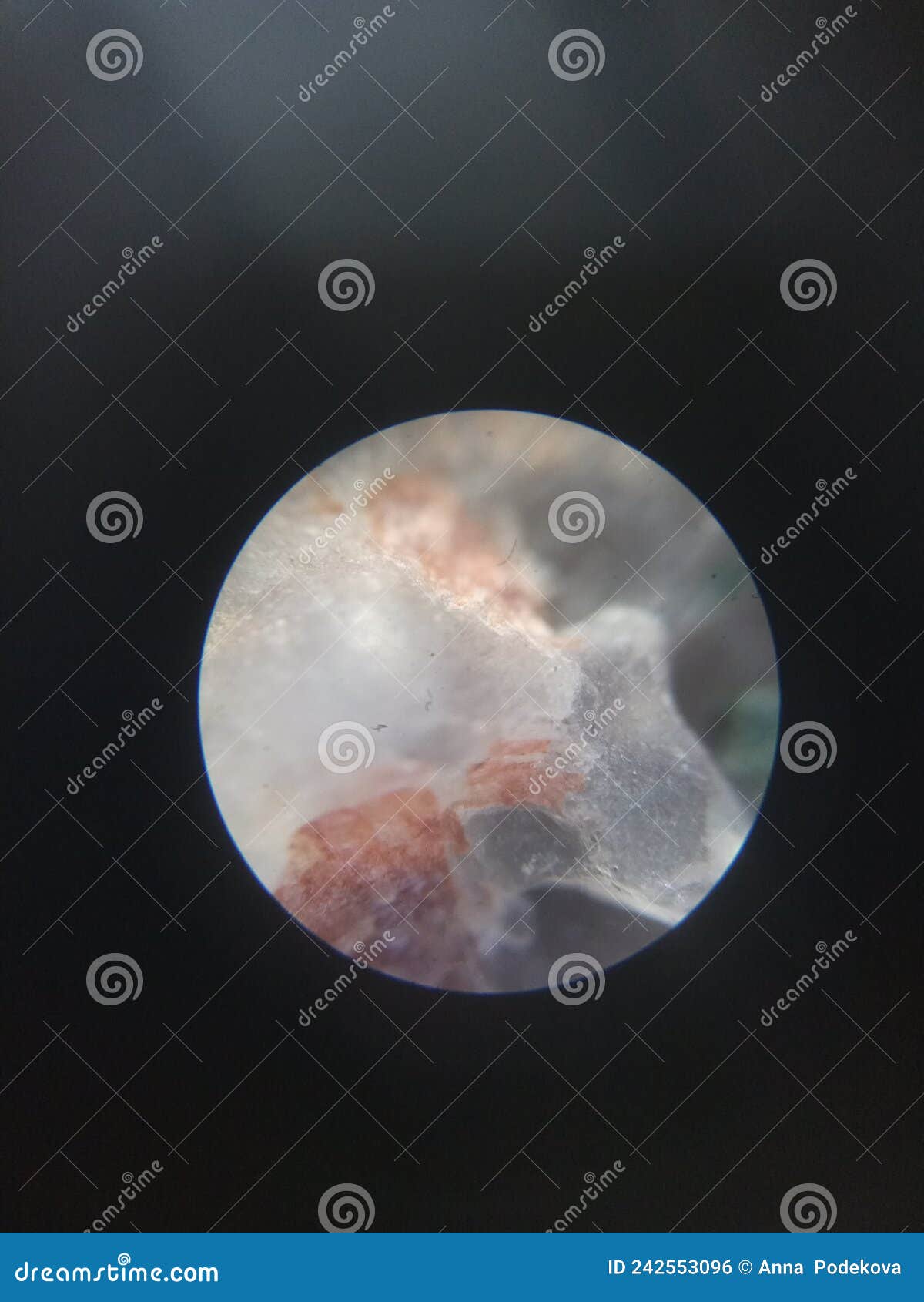 Agate Stone Under a Microscope. Stock Photo - Image of figure, hazelnut ...