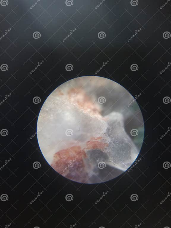 Agate Stone Under a Microscope. Stock Photo - Image of figure, hazelnut ...