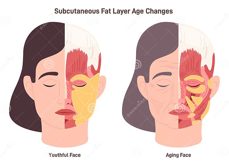 Age-related Skin Changes. Aging Process, Subcutaneous Fat Layer Changes ...