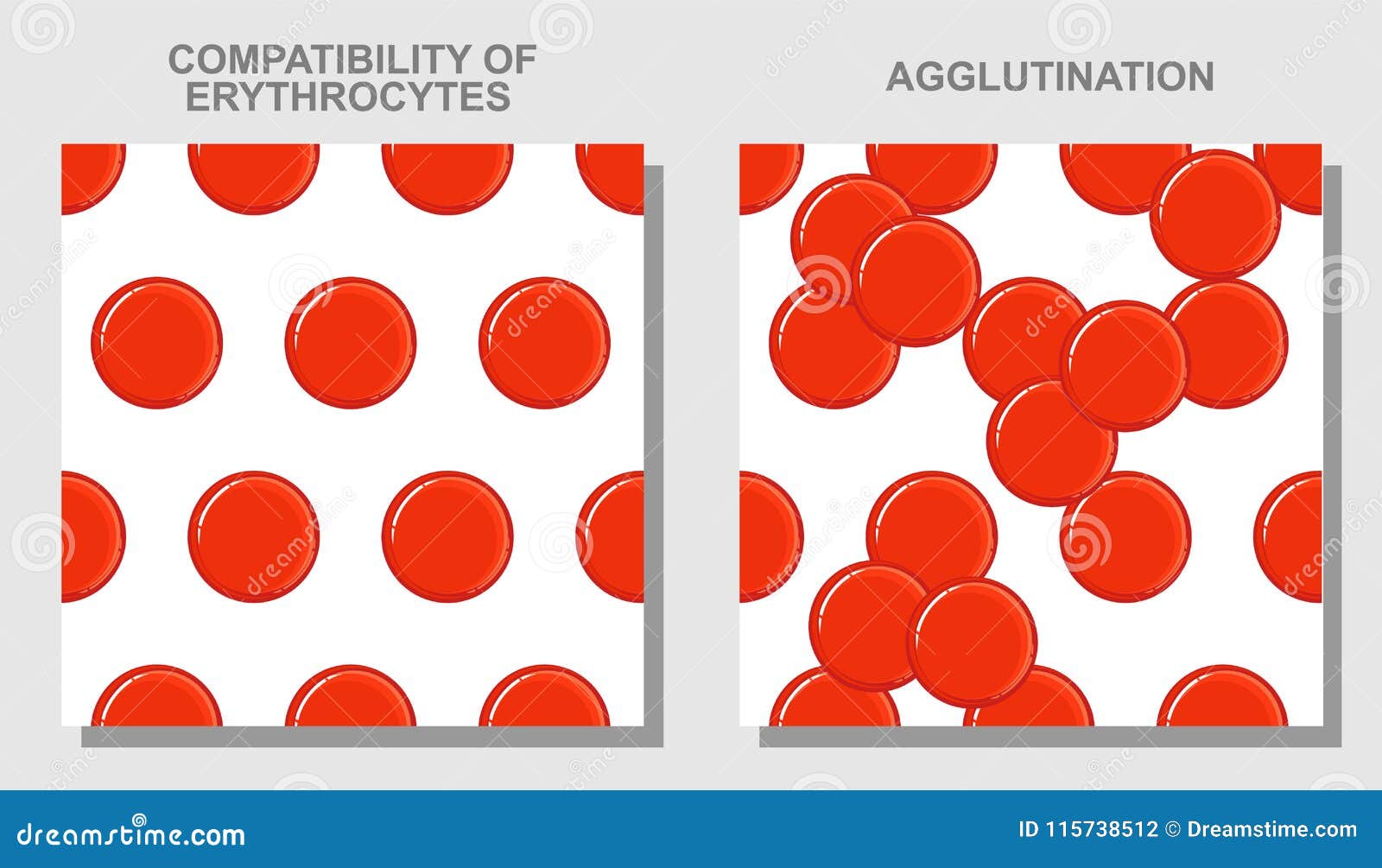 Agglutination Stock Illustrationer, Vektorer, & Clipart – (10 Stock ... Agglutination Stock Illustrationer, Vektorer, & Clipart – (10 Stock ...