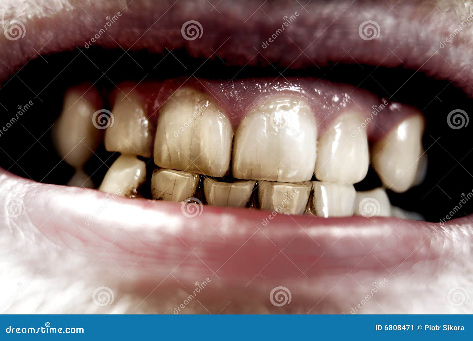 Aggressive teeth stock image. Image of bone, yellow, human - 6808471