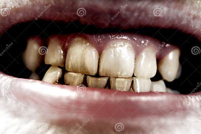 Aggressive teeth stock image. Image of bone, yellow, human - 6808471