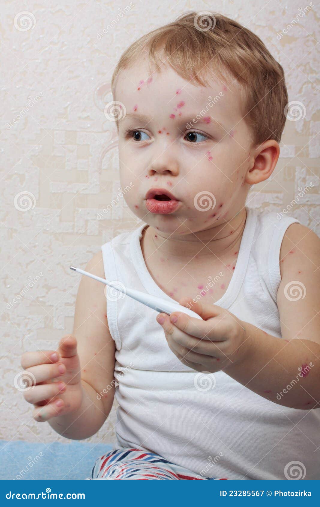Ailing child stock image. Image of ailing, sick, urticaria - 23285567