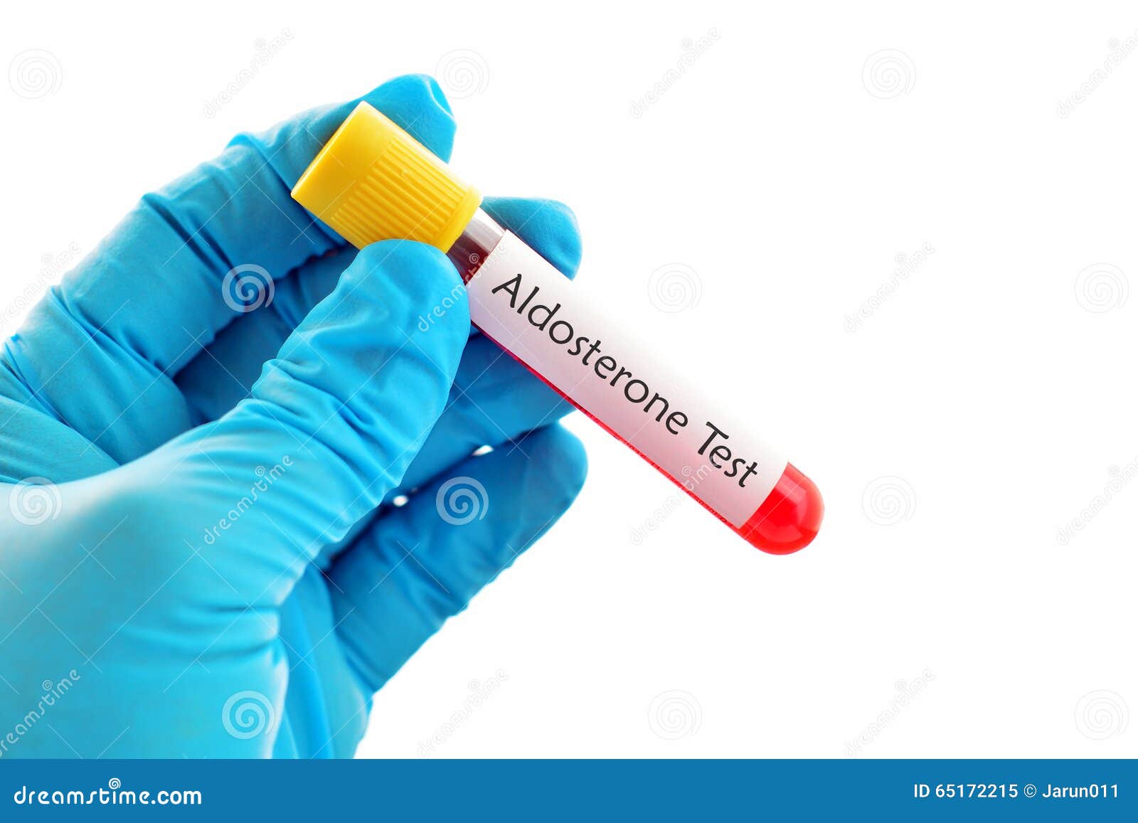 Aldosterone test stock image. Image of alkalosis, experiment - 65172215