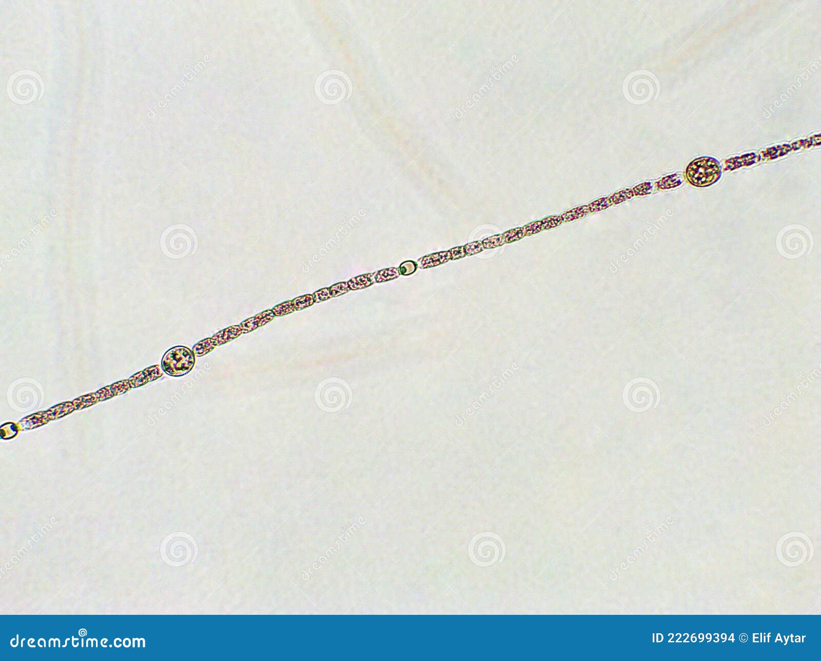 Algae Under Microscopic View, Akinete, Heterocyst, Cyanobacteria Stock ...