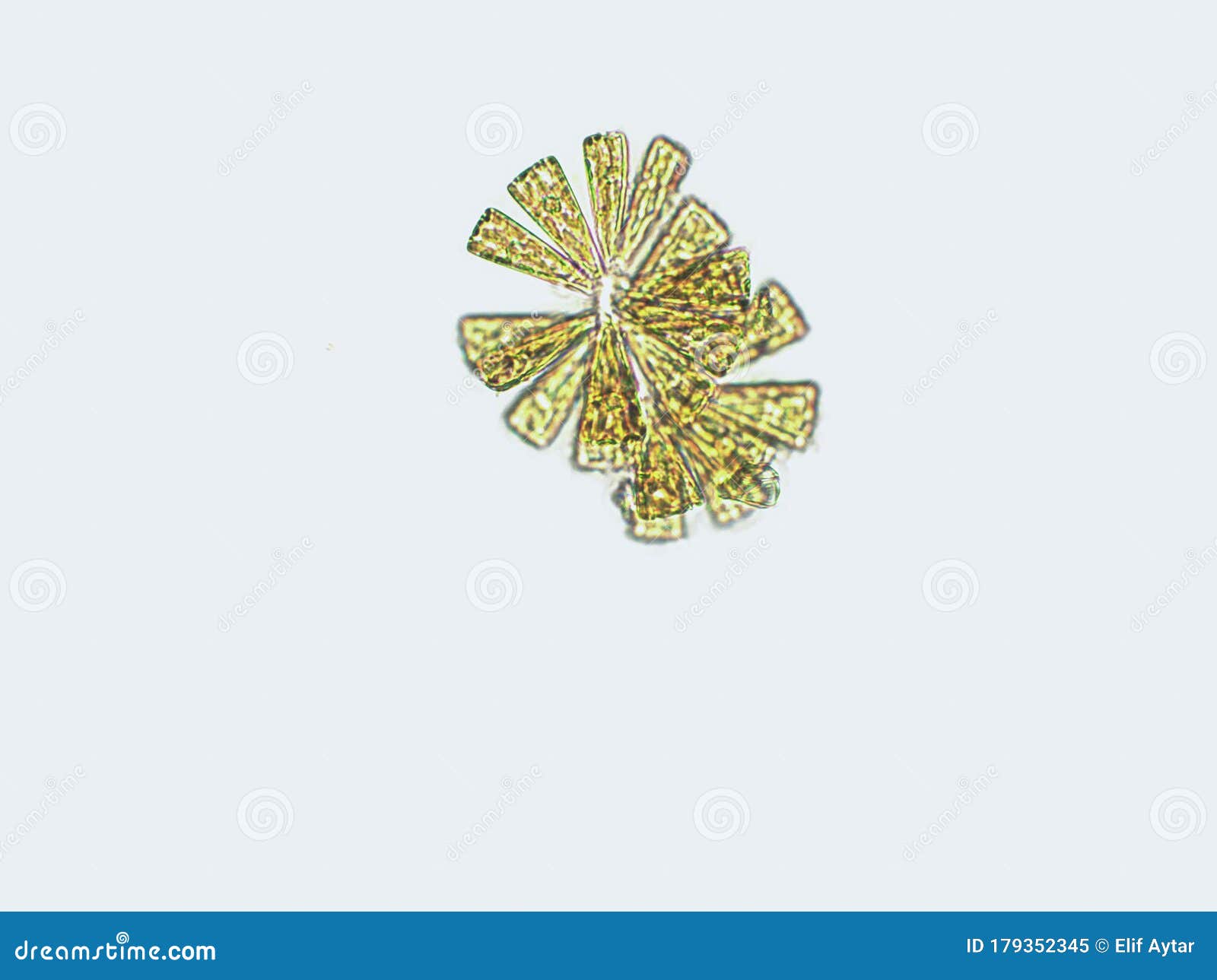 Algae Under Microscopic View X100 Stock Image - Image of laboratory ...