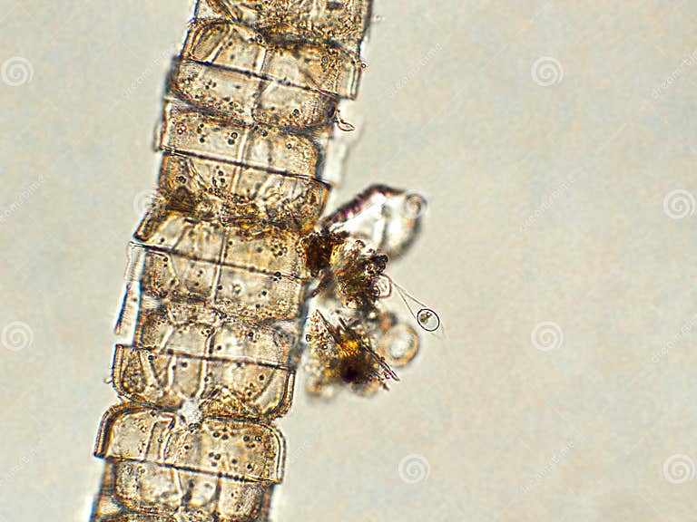 Algae with Zooplankton Under Microscopic View Stock Image - Image of ...