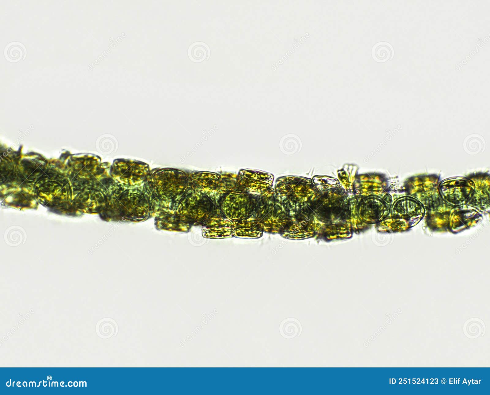 Algues Filamenteuses Vertes Bleues Sous Vue Microscopique Image stock ...