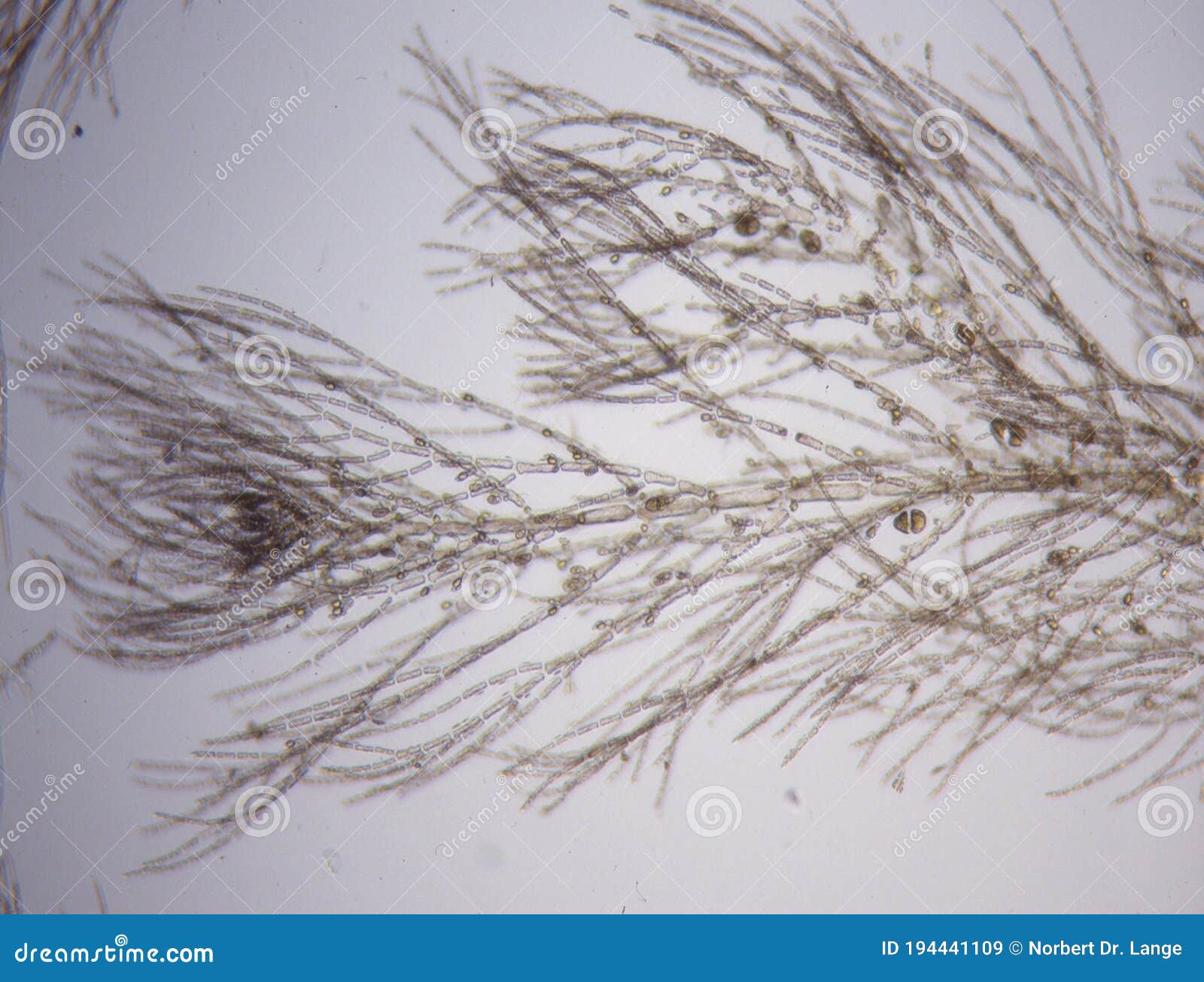 Algues Rouges Sous Le Microscope Image stock - Image du photosynthèse ...