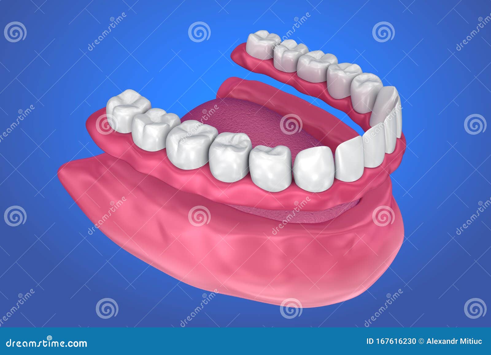 All Missing Teeth - Removable Full Denture Royalty-Free Cartoon ...