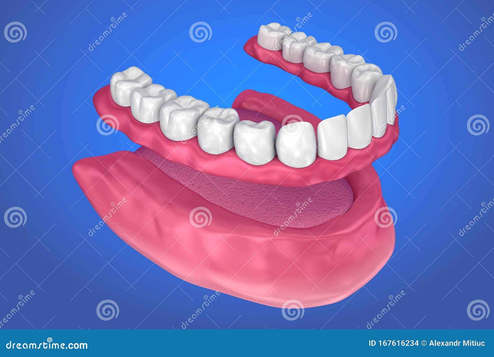 All Missing Teeth - Removable Full Denture Royalty-Free Cartoon ...