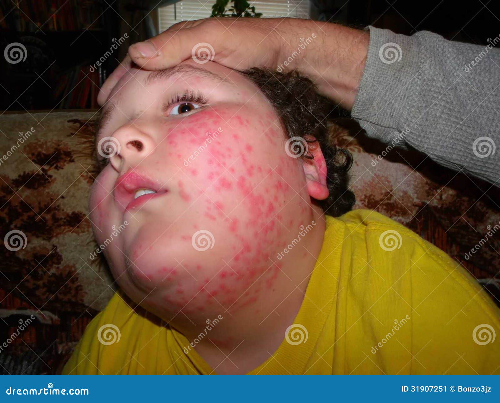 Allergic Reaction stock image. Image of sick, animals - 31907251