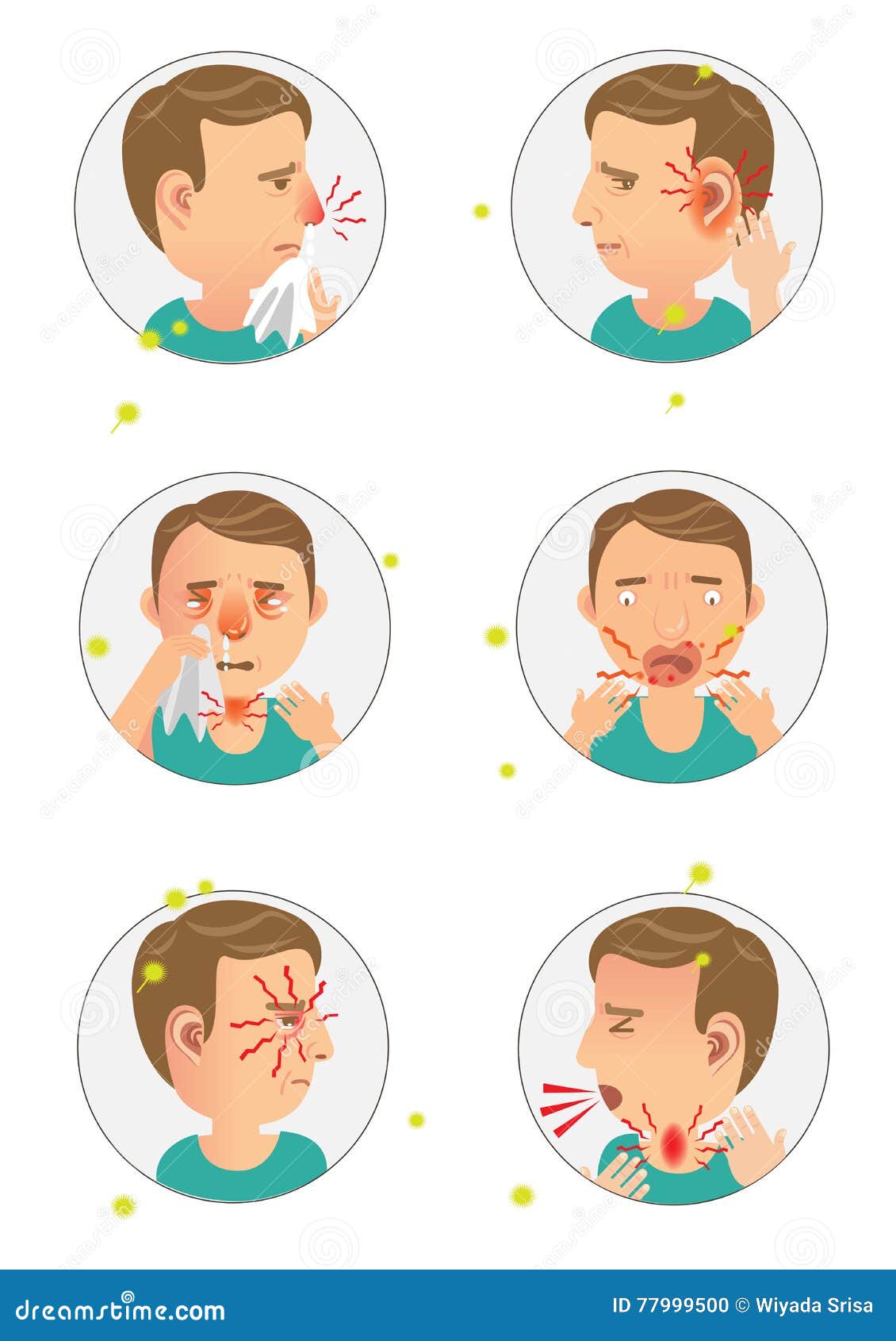 Allergic stock vector. Illustration of cartoon, rhinitis - 77999500