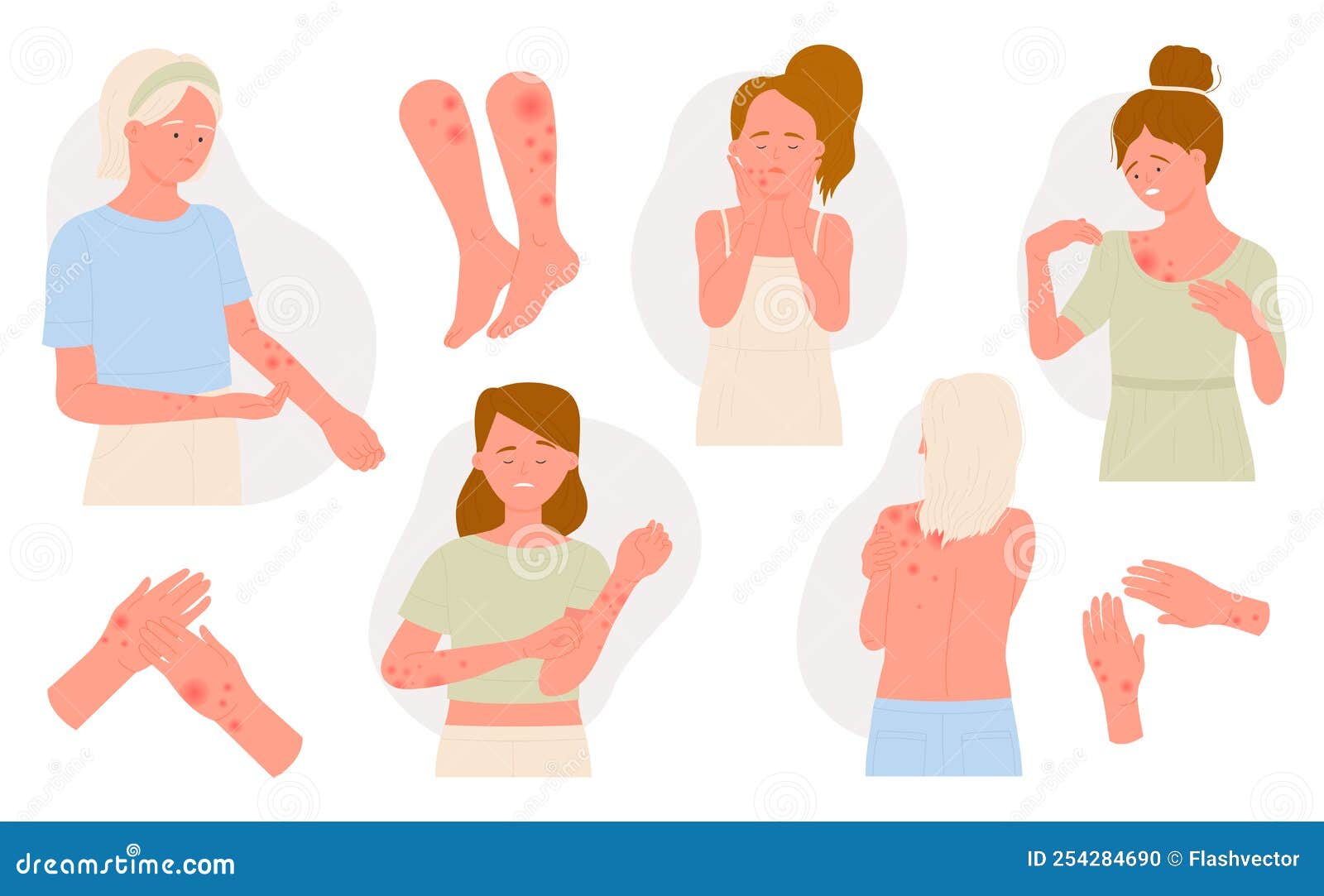 Allergy On Body Skin Set Dermatology Medical Infographics Allergic