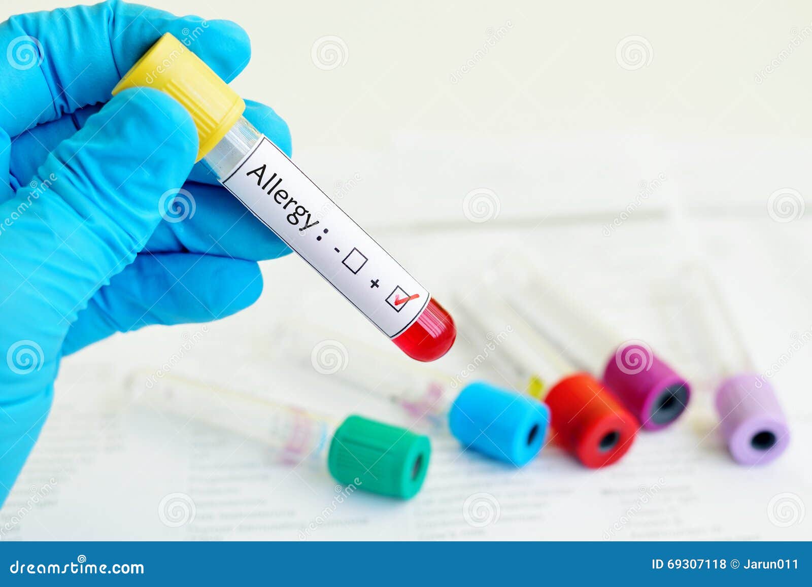 Allergy positive stock photo. Image of checkup, serology - 69307118