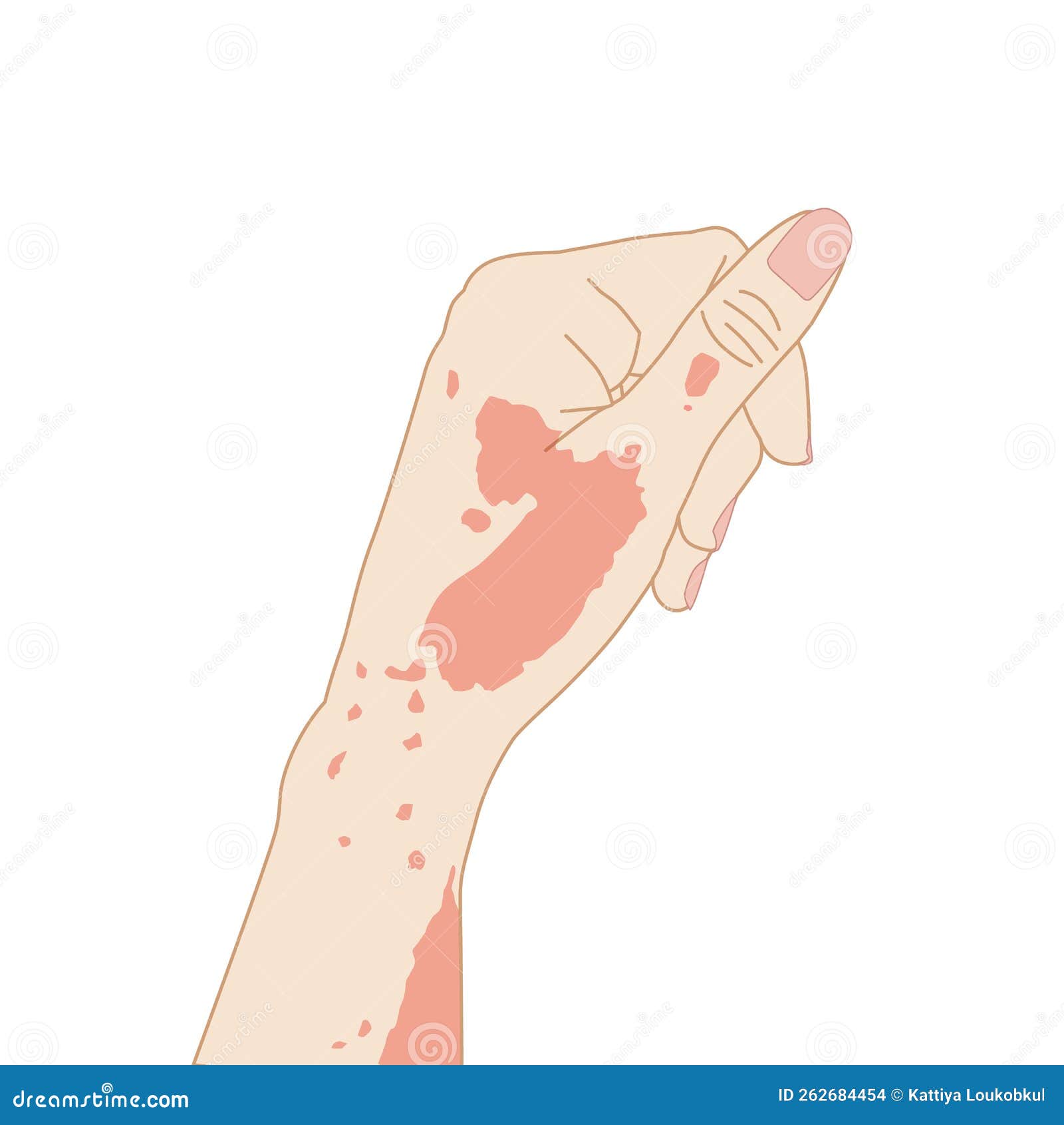 Urticaria Flat Landing Page Website Template. Tularemia, Warkany ...