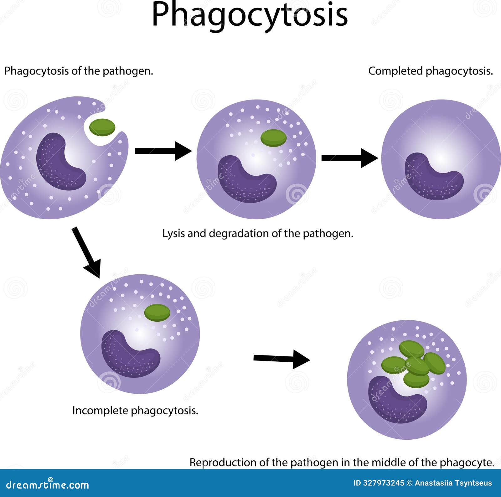 Allergy is a Response of the Immune System. Stock Illustration ...