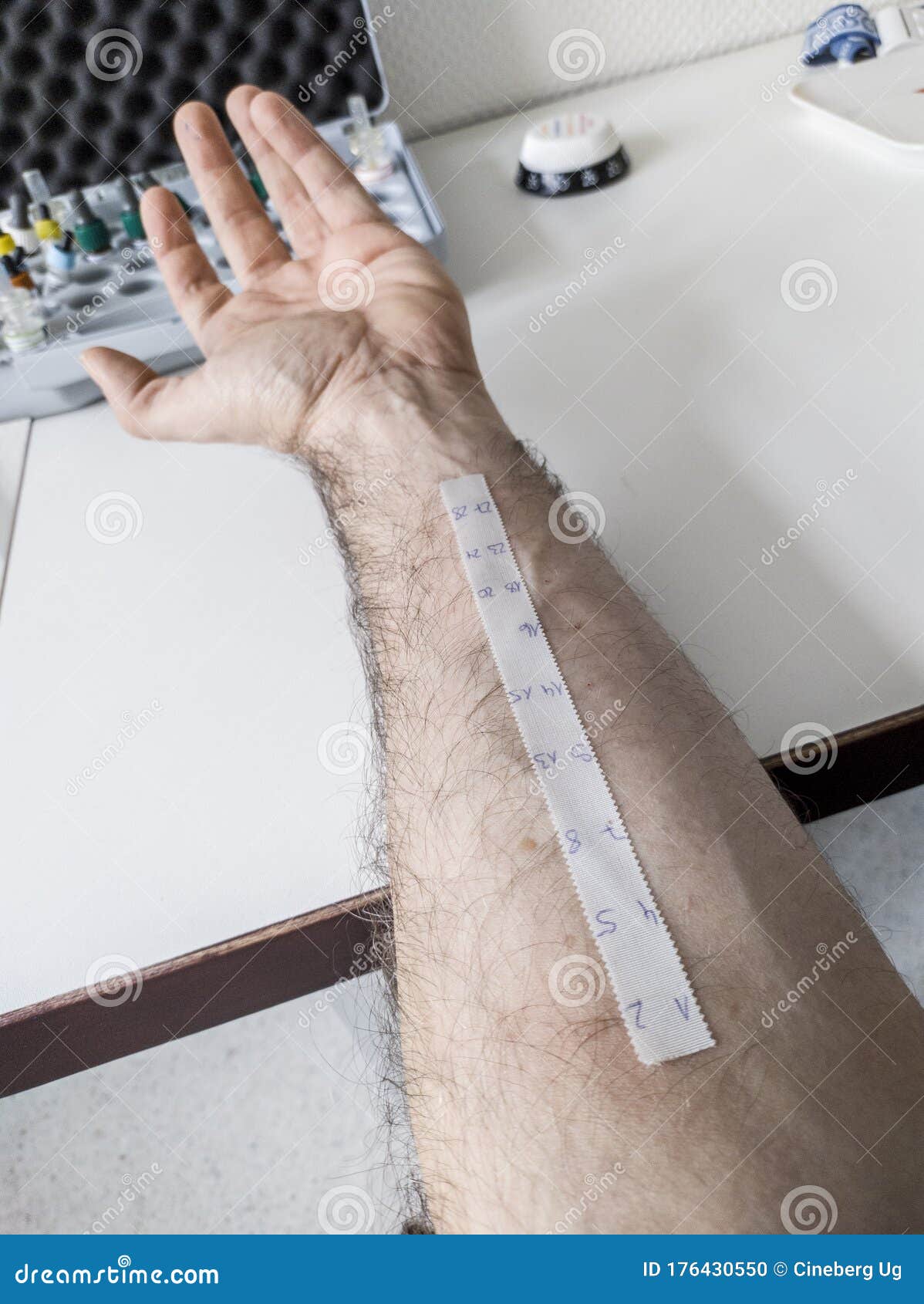 Allergy scratch test stock photo. Image of care, allergen - 176430550