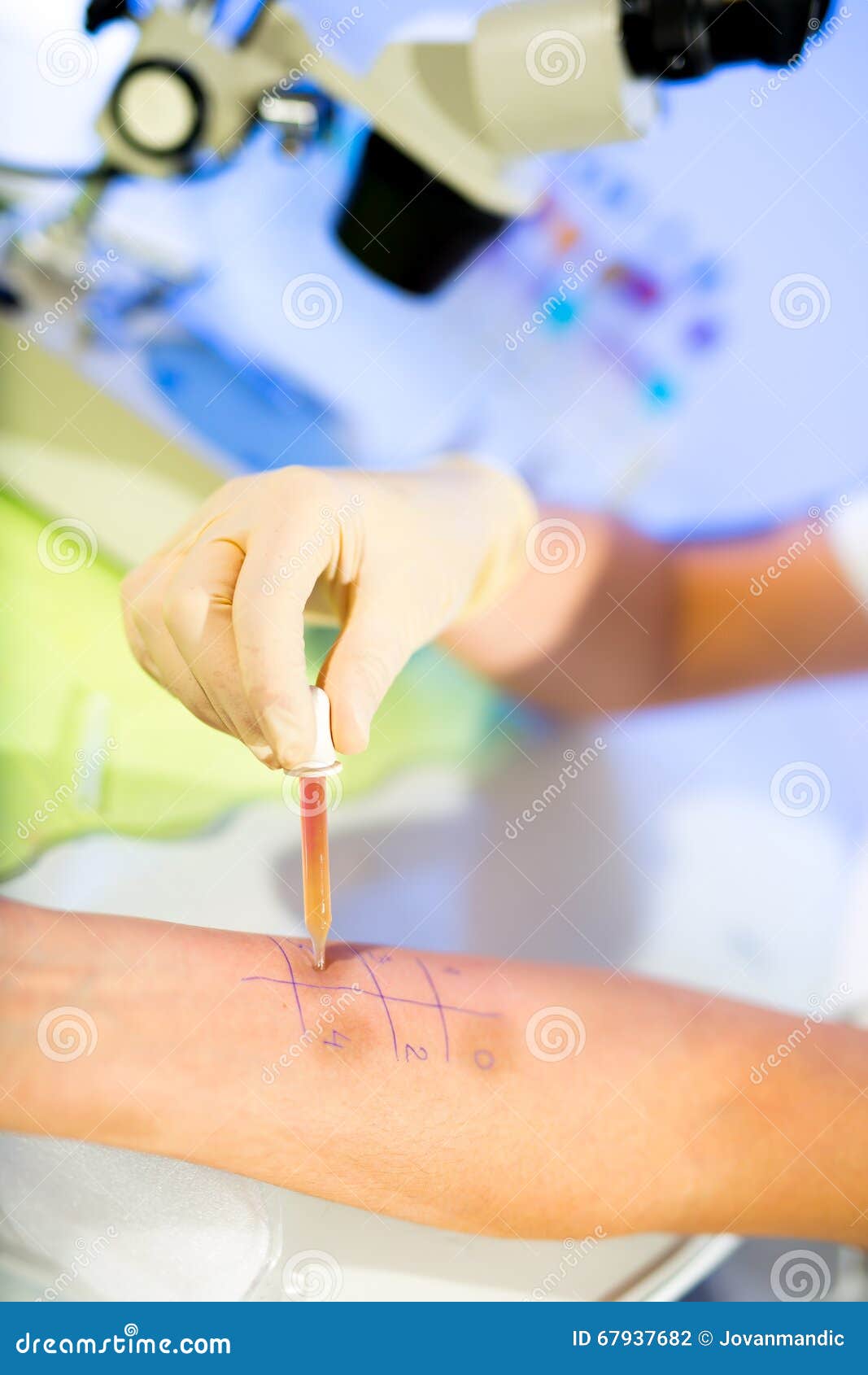 Allergy - skin tests stock photo. Image of clinical, medicine - 67937682