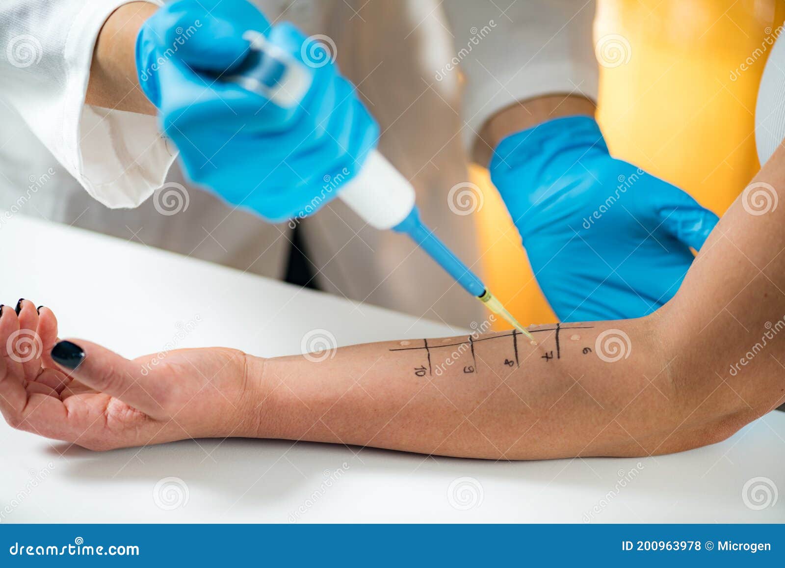 Allergy - Skin Testing stock photo. Image of blister - 200963978