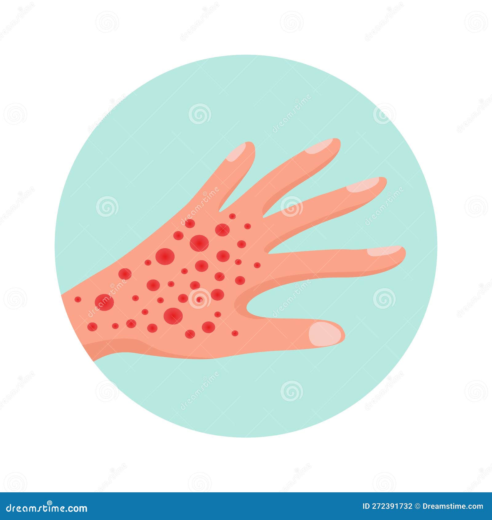 Allergy Symptom Icon stock vector. Illustration of test - 272391732