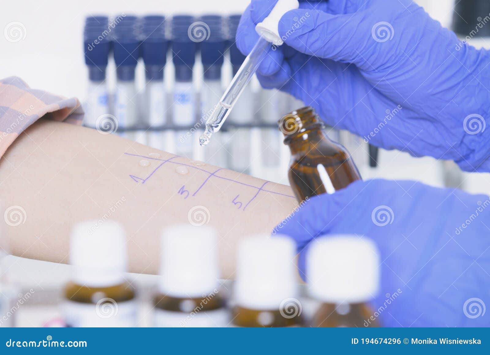 Allergy Tests in Laboratory Stock Photo - Image of medical, allergen ...
