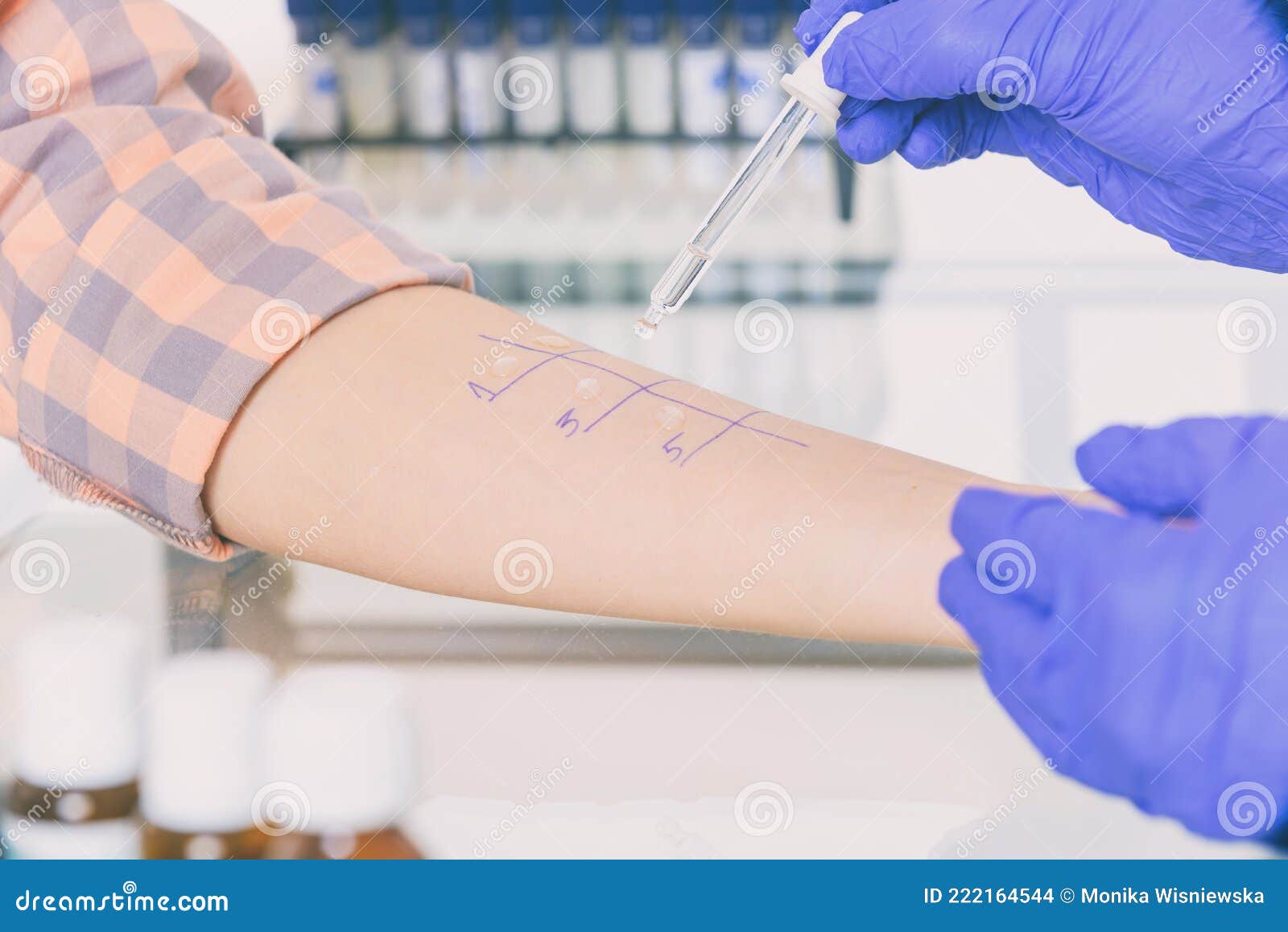 Allergy Tests in Laboratory Stock Photo - Image of allergen, allergy ...