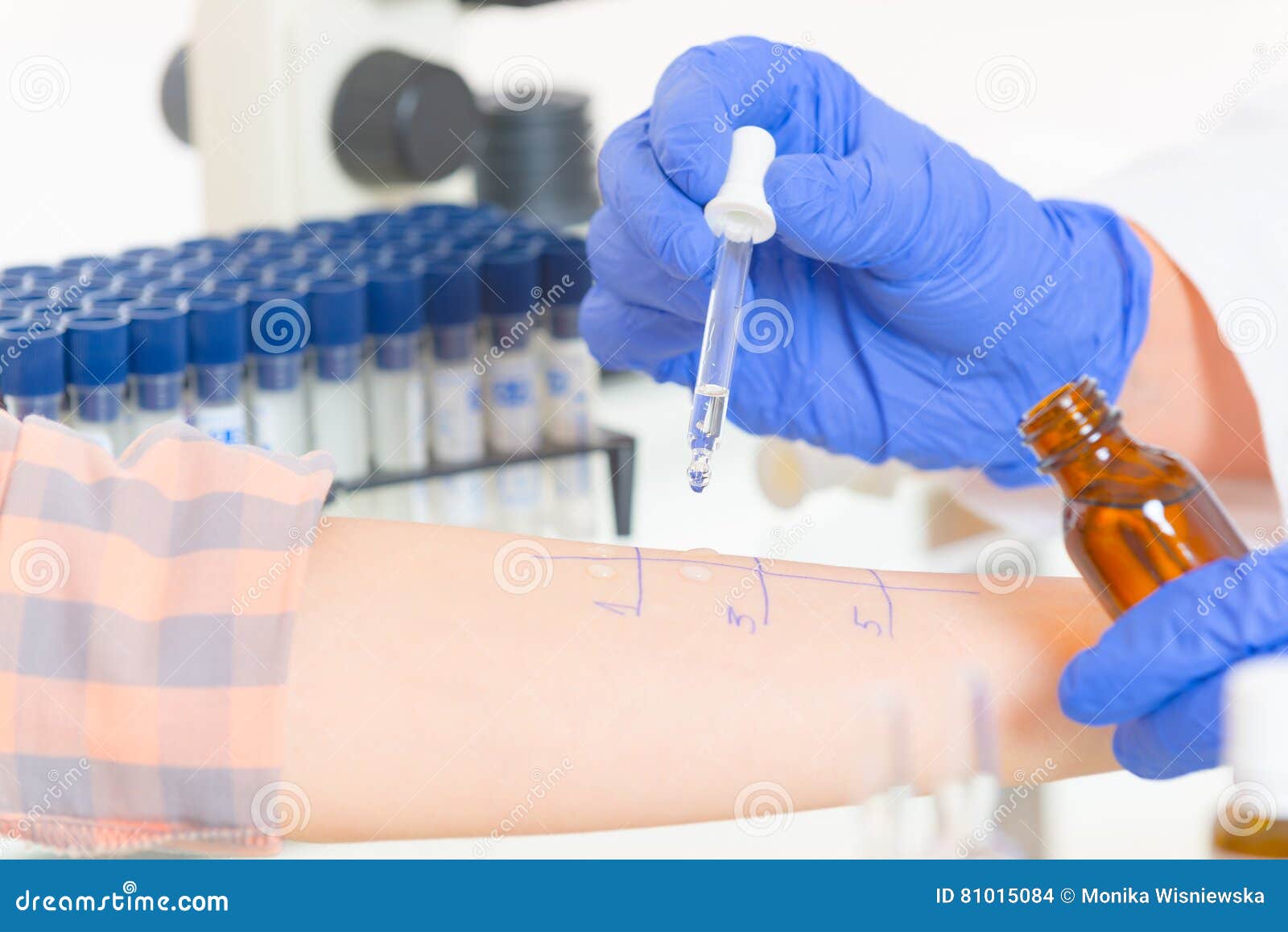 Allergy Tests in Laboratory Stock Photo - Image of analysis, experiment ...