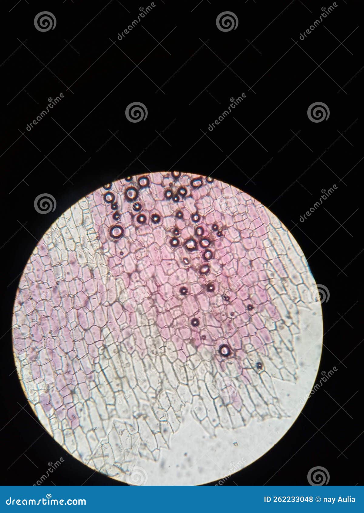 Allium Cepa & X28;Red Onion Under Microscope& X29; Stock Photo - Image ...