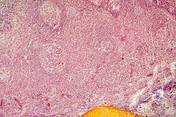 Almond Tonsils in Cross Section Stock Image - Image of organs, palate ...