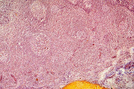 Almond Tonsils in Cross Section Stock Image - Image of organs, palate ...