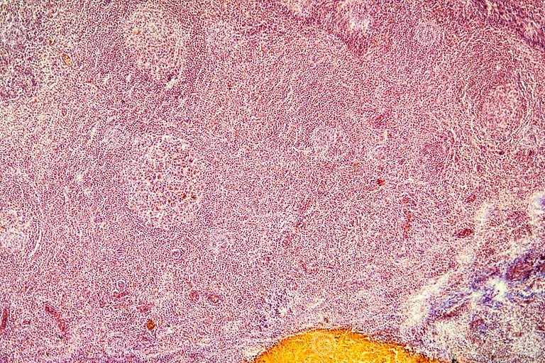 Almond Tonsils in Cross Section Stock Image - Image of organs, palate ...