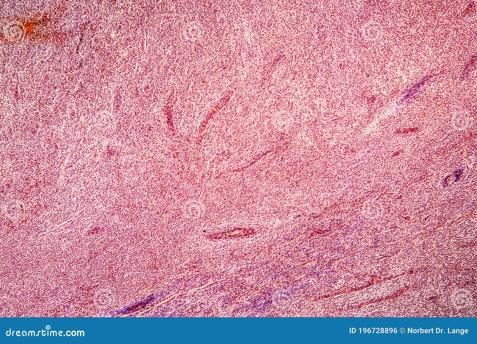 Almond Tonsils in Cross Section Stock Photo - Image of magnification ...