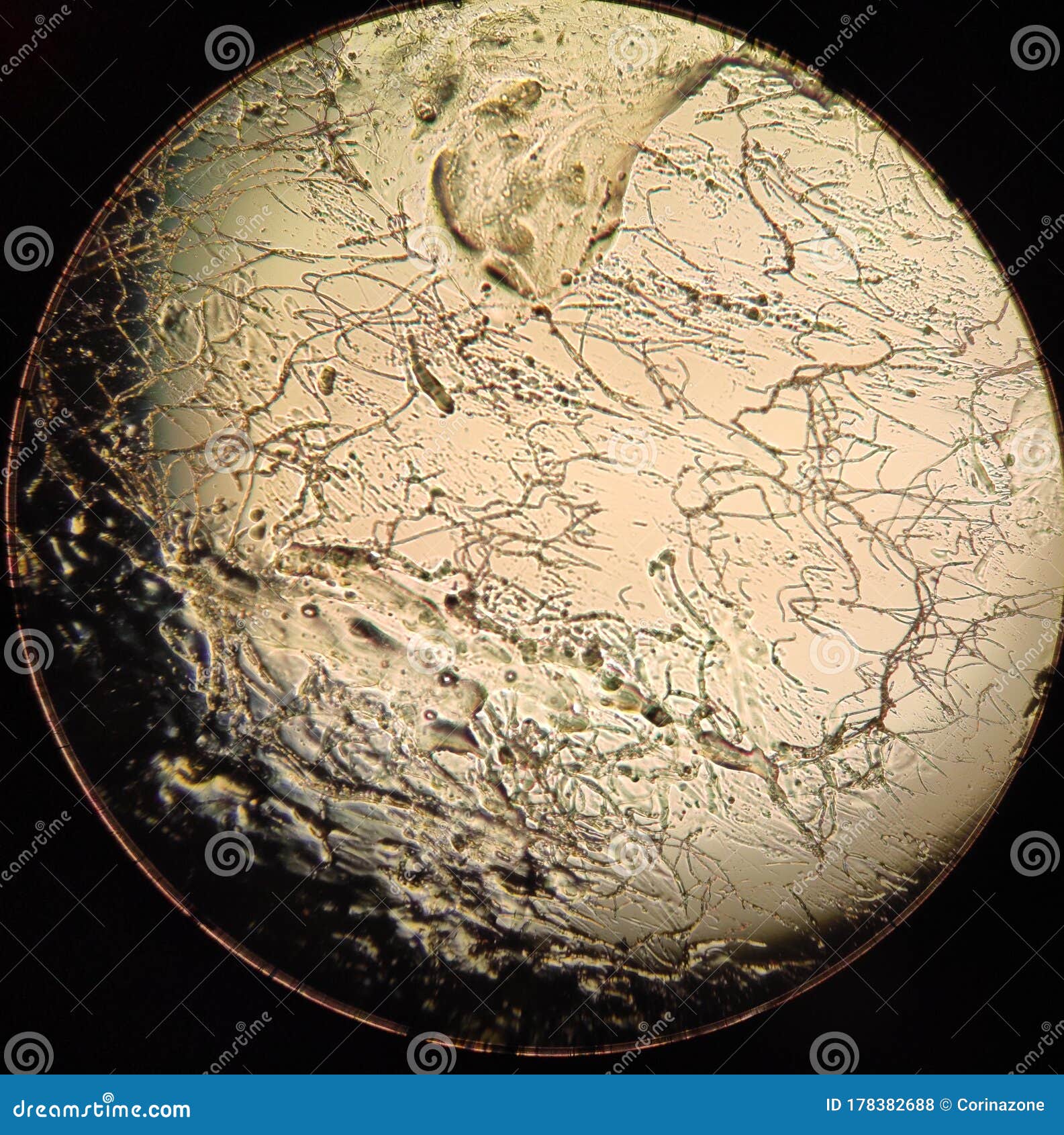 Alternaria Fungal Mycelium Under the Microscope Stock Photo - Image of ...