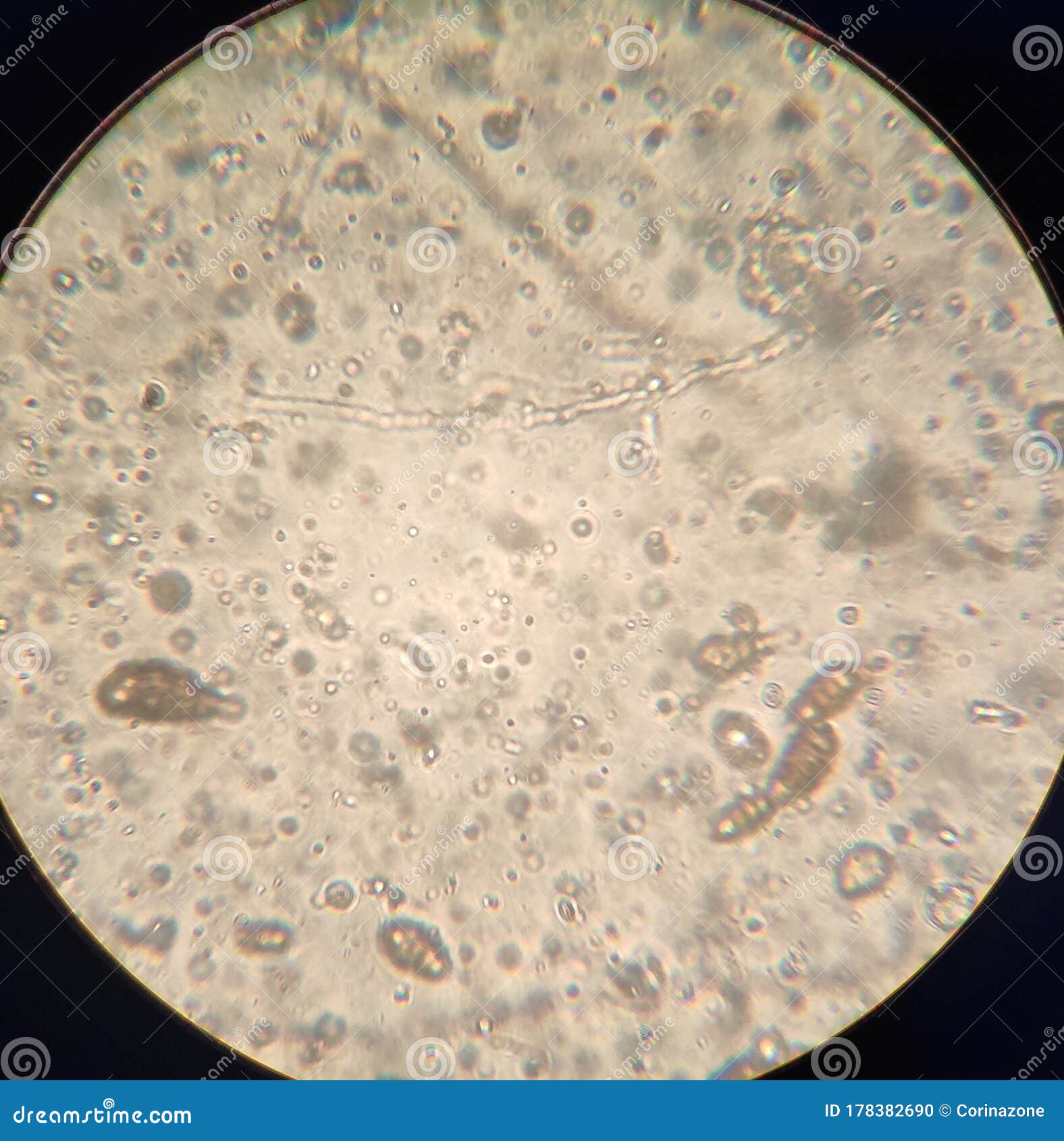 Fungal Spore Trichuris Egg