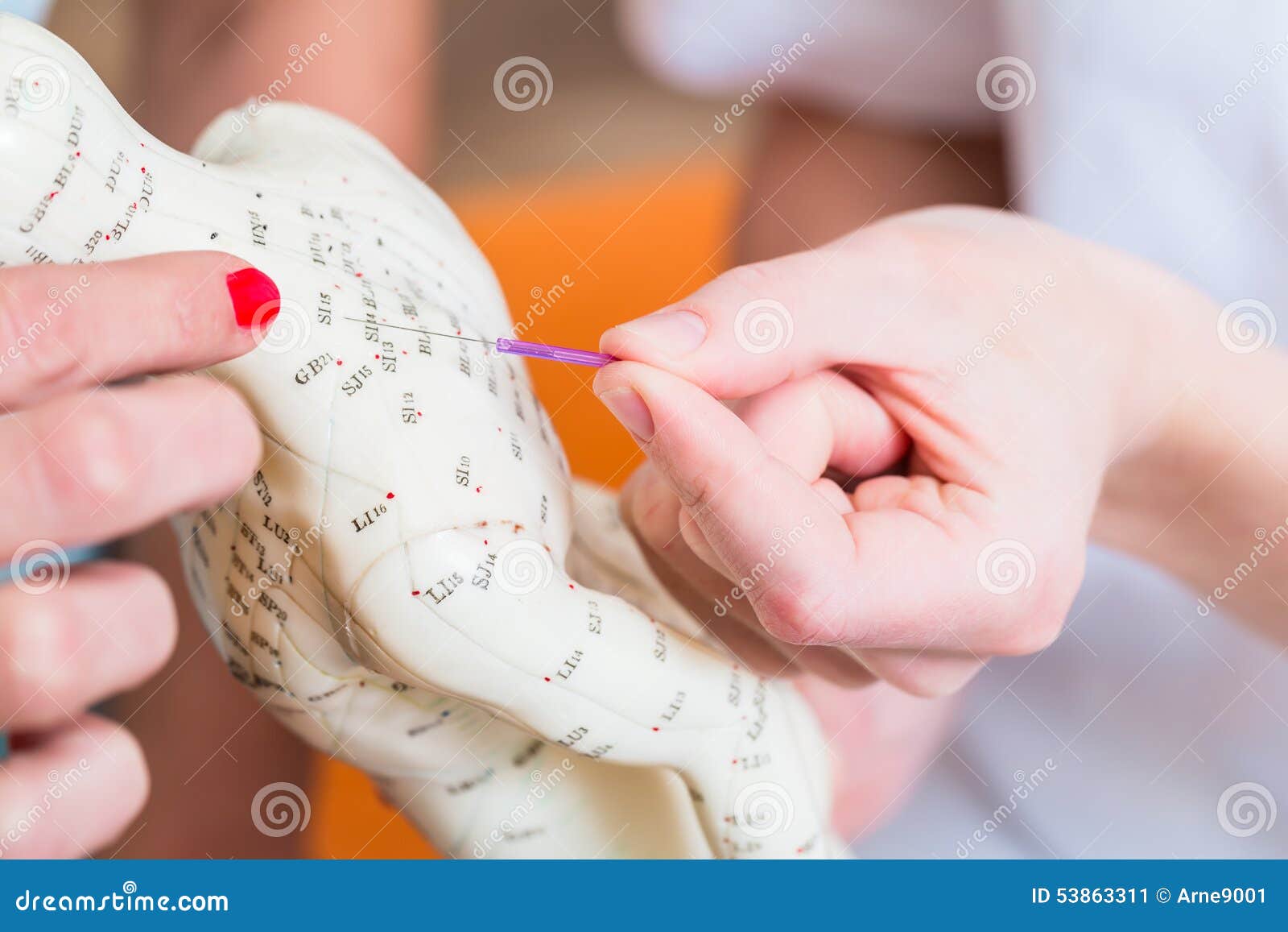 Alternative Practitioner Explaining Acupuncture Stock Image - Image of ...