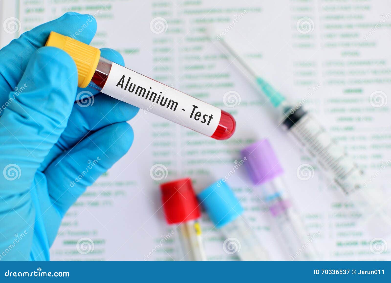 Aluminium test stock image. Image of medicine, mercury - 70336537