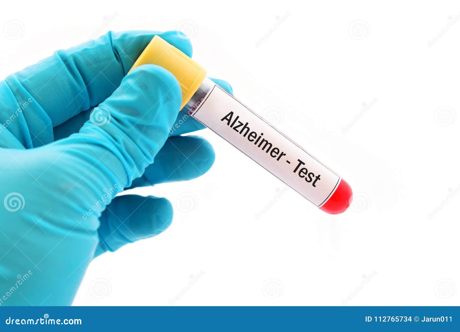 Alzheimer disease test stock photo. Image of cerebral - 112765734