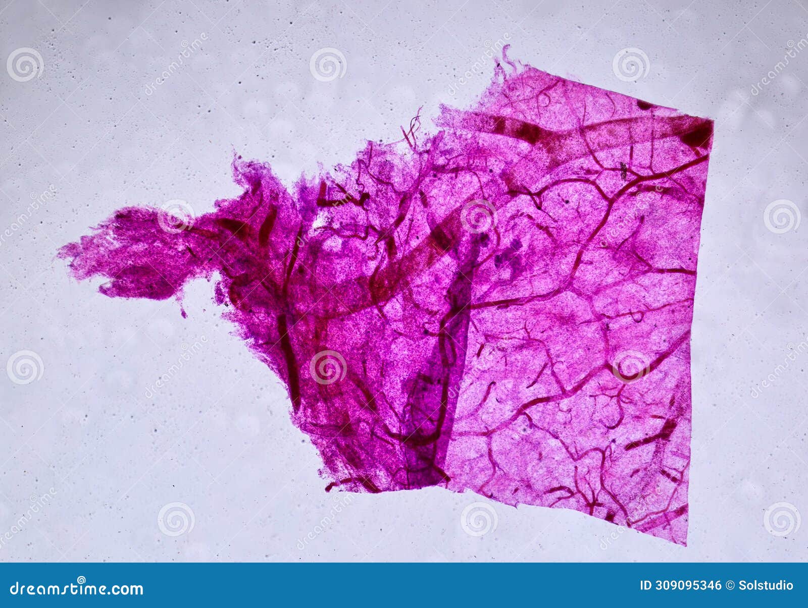 Life under a microscope stock photo. Image of bacteria - 309095346